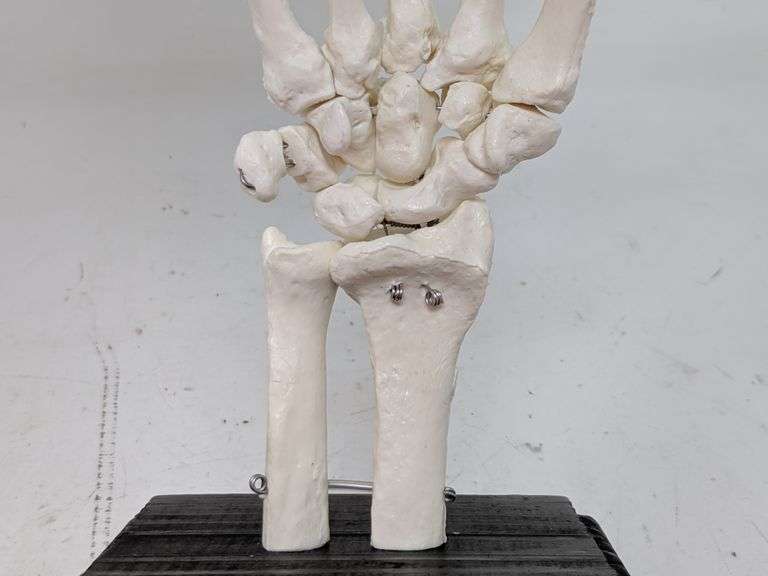 The Blackened Teeth - Skeleton Hand - Dutch Goat