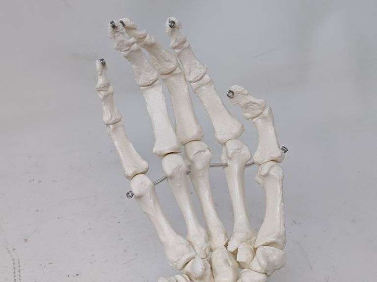 The Blackened Teeth - Skeleton Hand - Dutch Goat